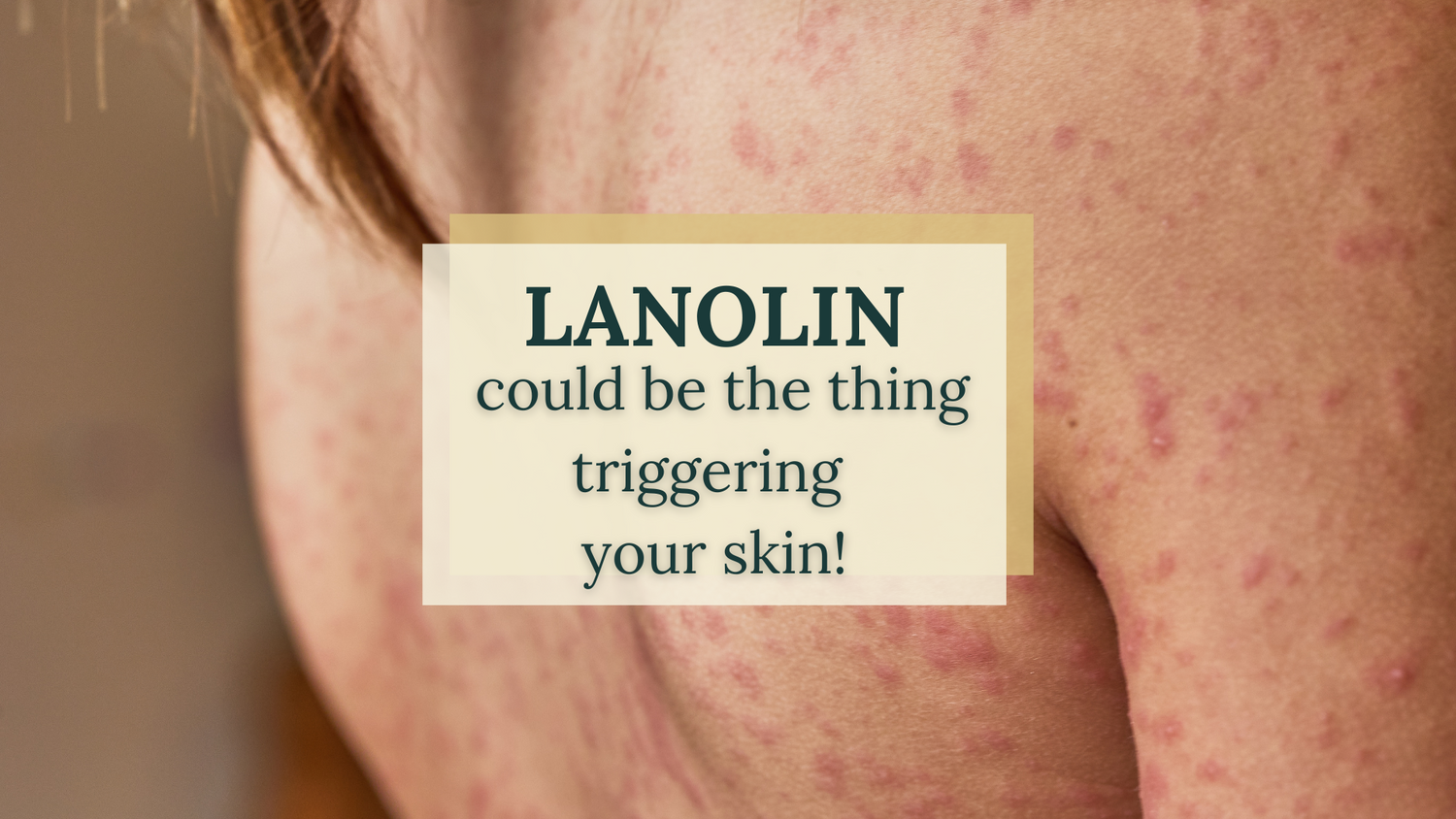 The Benefits of Using Lanolin-Free Products for Sensitive Skin ...